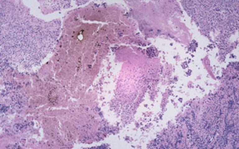 Skin cancer photo triage reduces waiting time - Management In ...